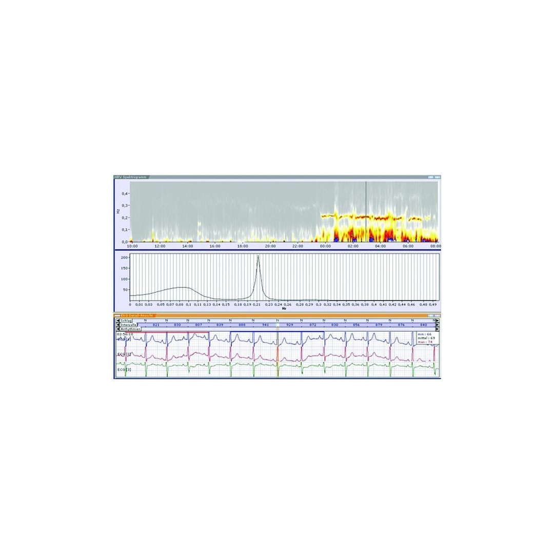 Holter ECG SCHILLER medilogAr et logiciel DARWIN