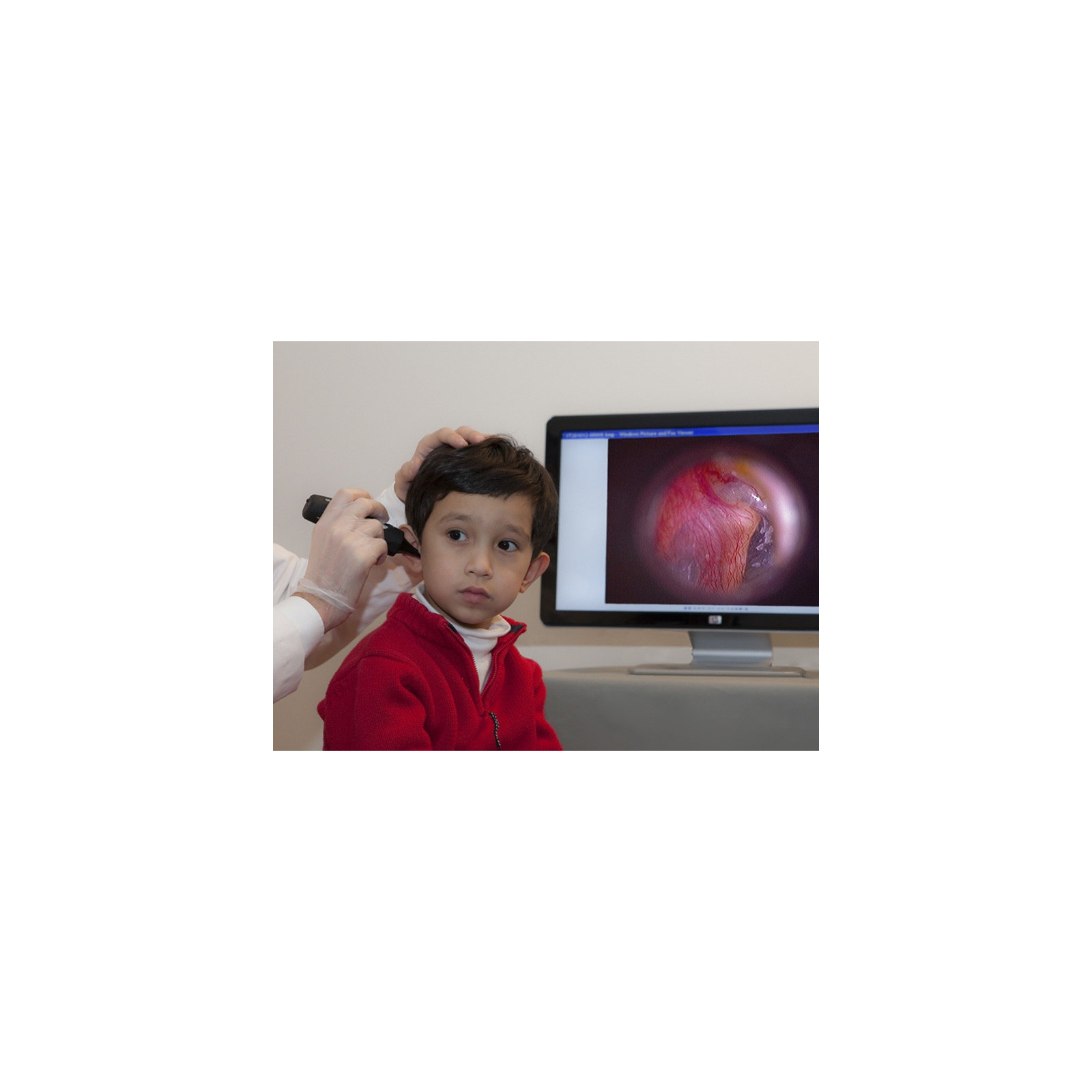 Otoscope vidéo sans fil Firefly DE550