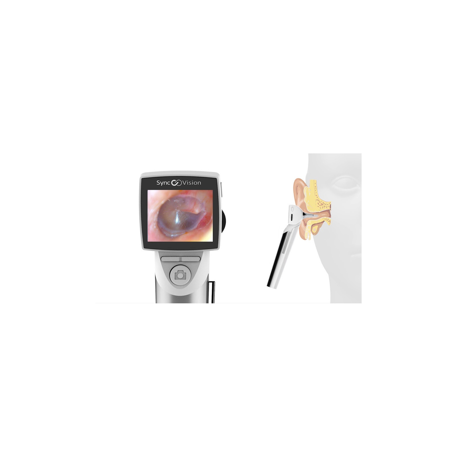 Otoscope digital IO1 Elite SyncVision