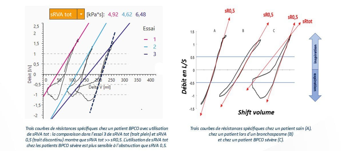 Pourquoi et Comment mesurer et interpréter les RVA / RaW dans votre ...