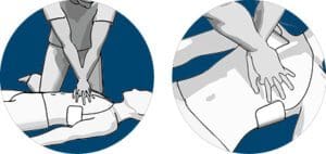 Comment réaliser un massage cardiaque efficace ? | Blog du matériel médical